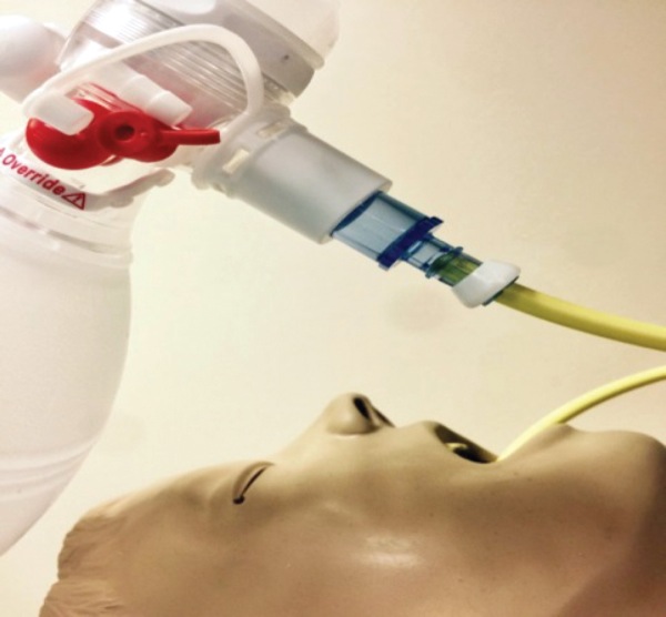 Exchanging Endotracheal Tubes In Adults Outside The Operating Room