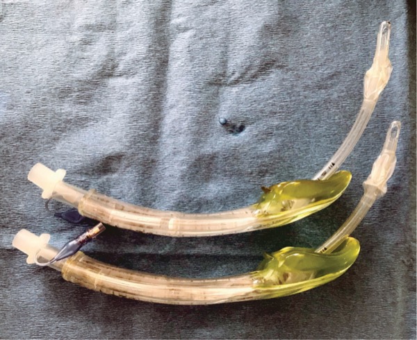 The Supraglottic Airway Device: Its Role as an Intubating Conduit