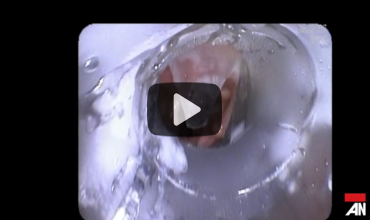 Airway on Demand: Proper Positioning of the Fastrach LMA Epiglottic ...