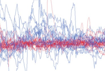 Closed-Loop Vasopressor System Reduces Hypotension In Cardiac Patients