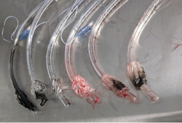 Rare Airway Fires Still Occur With Air- and Saline-Filled Endotracheal ...