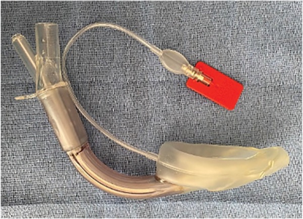 Utilizing a Supraglottic Airway Device as an Intubation Conduit