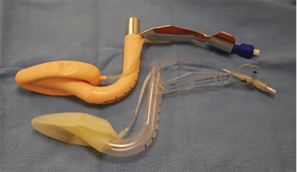 Utilizing a Supraglottic Airway Device as an Intubation Conduit