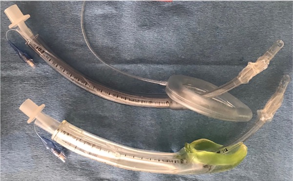 Utilizing a Supraglottic Airway Device as an Intubation Conduit
