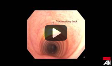 Latest Review Describes ESP Block Efficacy, Usage Patterns